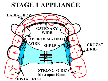 Biobloc治療導入セミナーを受講しました。 – いいじま歯科クリニック採用サイト